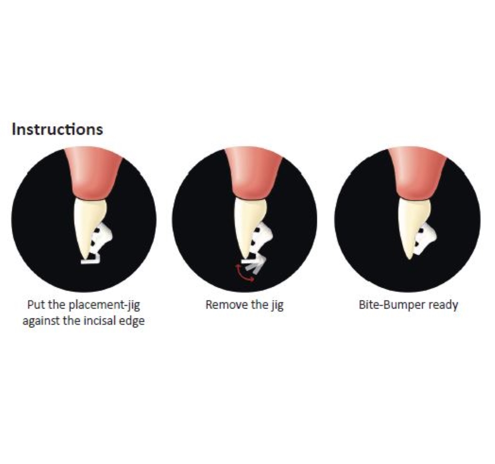 Bite Bumper™ (10 ct) - Young Specialties