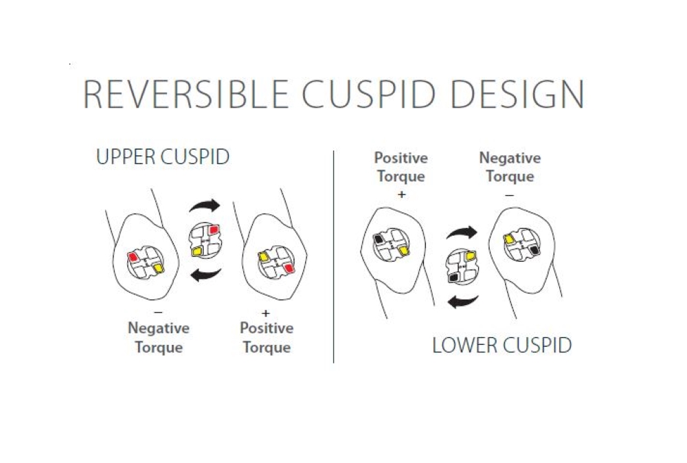 (Each) .020 Variable Torque Appliance Bracket System - Young Specialties